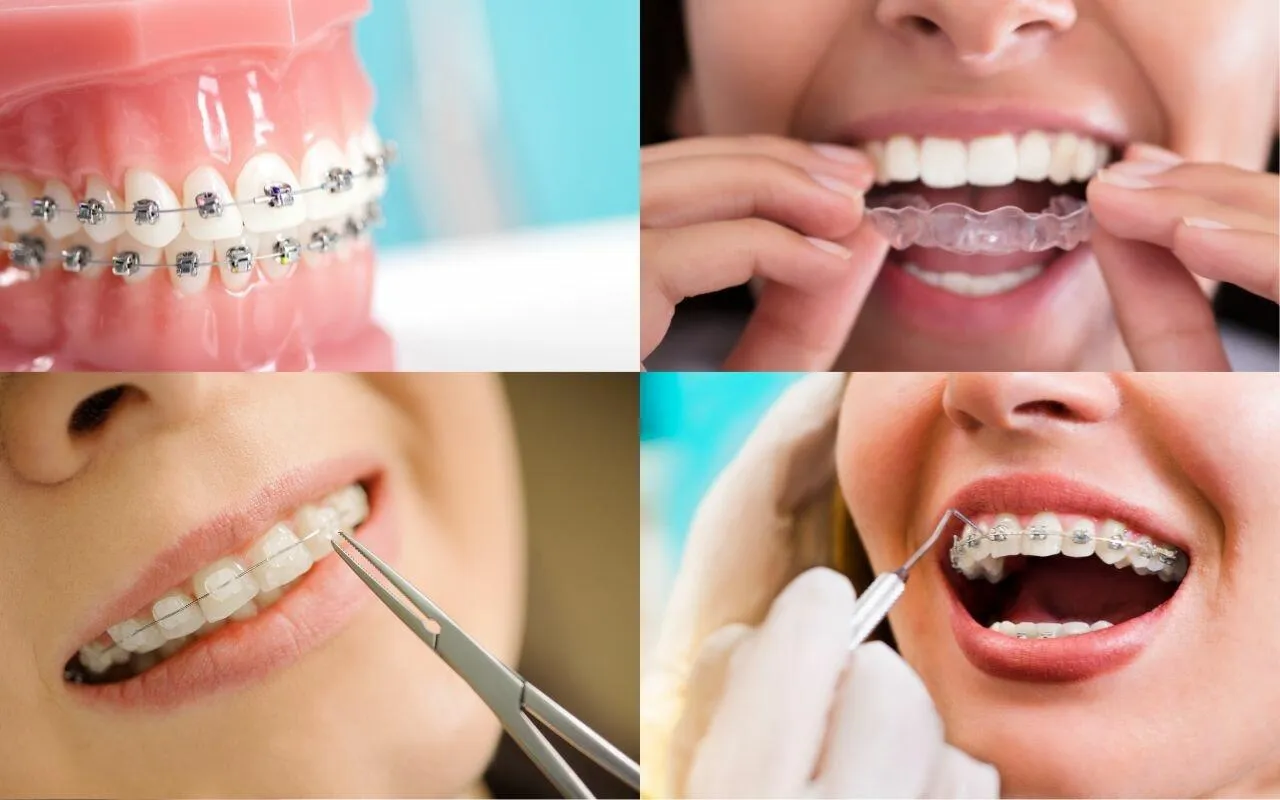 How Does Orthodontic Treatment Work? - Bradford Family Dentistry