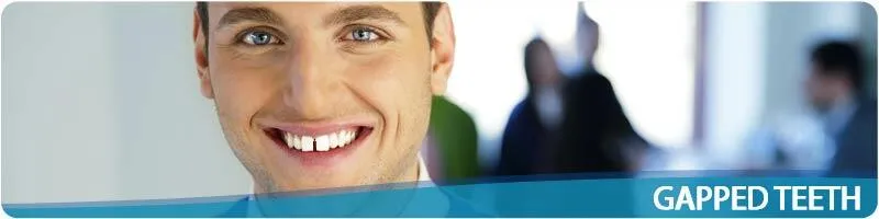 gapped-teeth - Bradford Family Dentistry