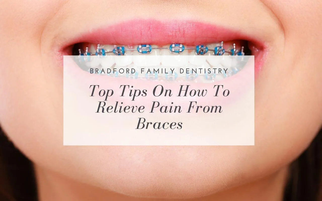 Top Tips On How To Relieve Pain From Braces - Bradford Family Dentistry